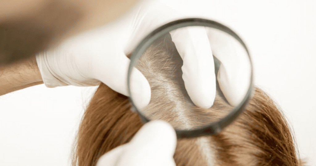 Hair Treatment | Gates Medical
